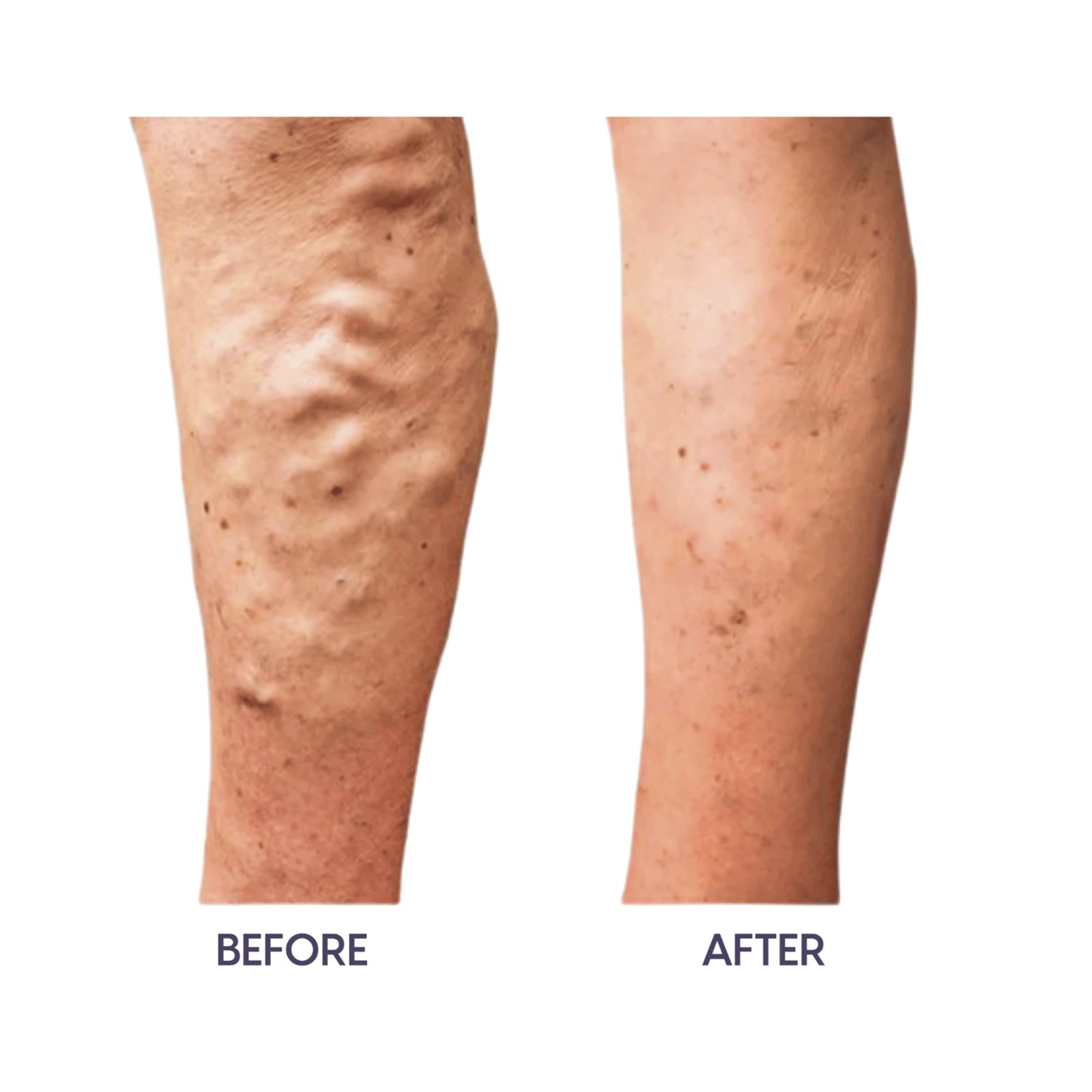 Vari-Smooth Leg Cream | Harriet Carter